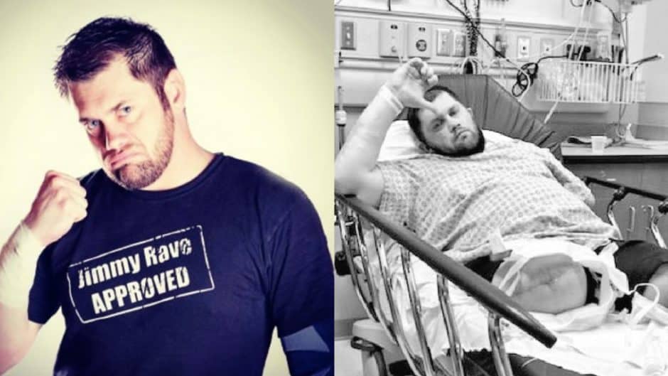 Former Professional Wrestler, Jimmy Rave, Has Both Legs Amputated