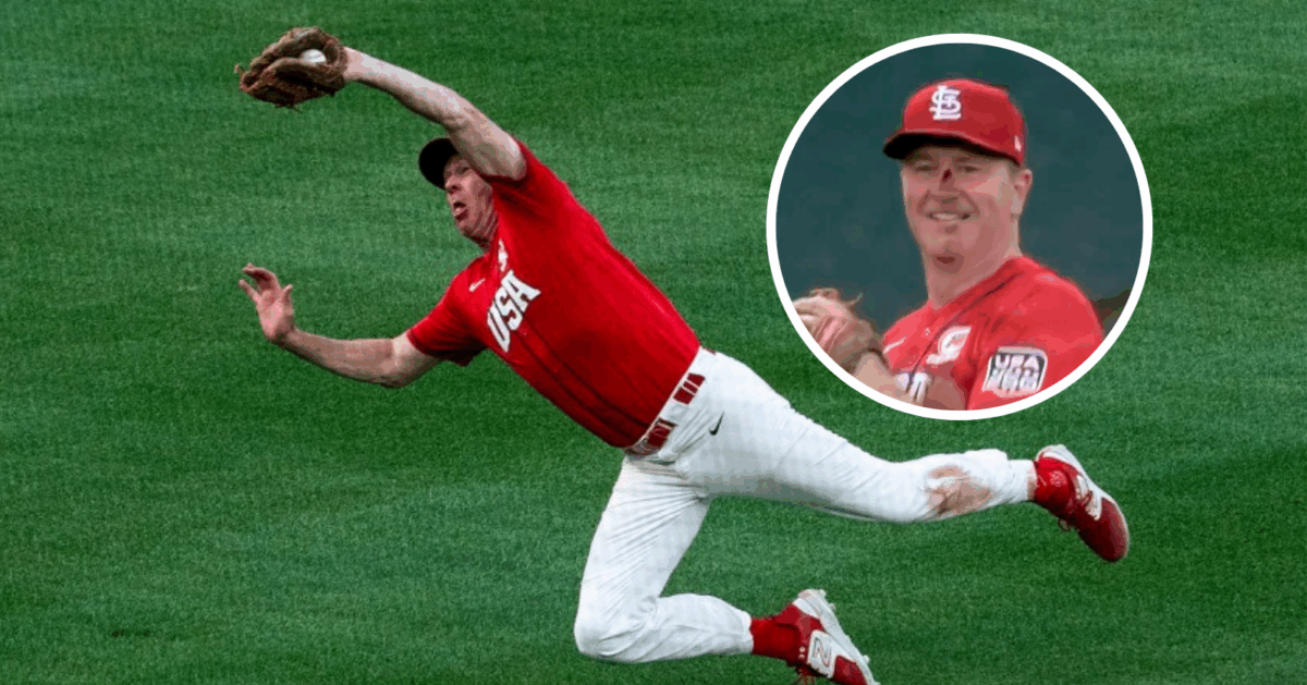 Daring Catch Leaves Senator Bleeding During Congressional Baseball Game